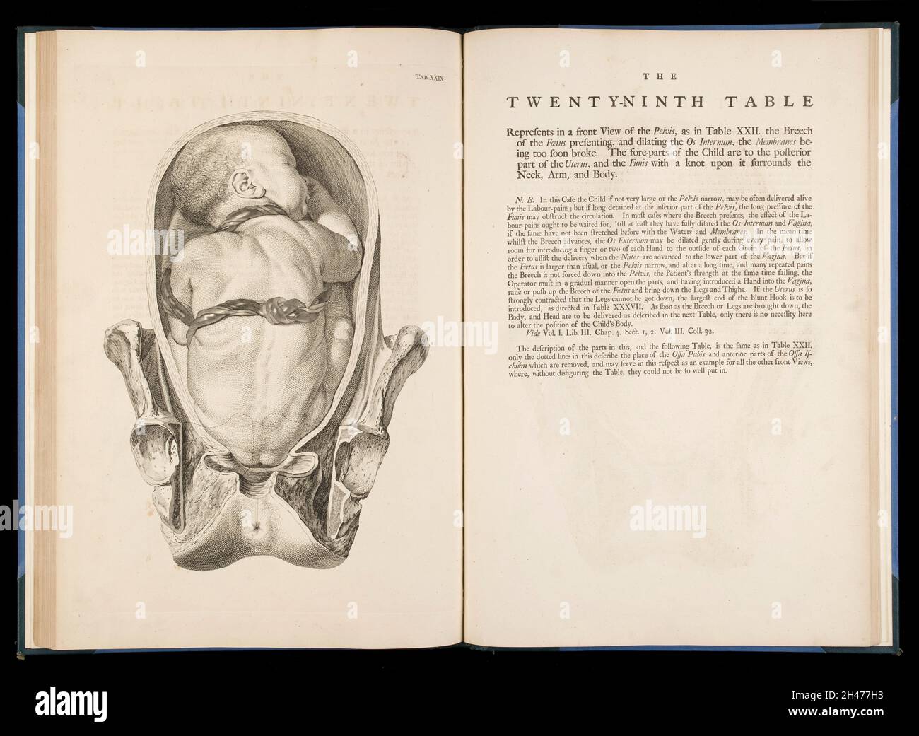 The twentyninth table from "A sett of anatomical tables Stock Photo - Alamy