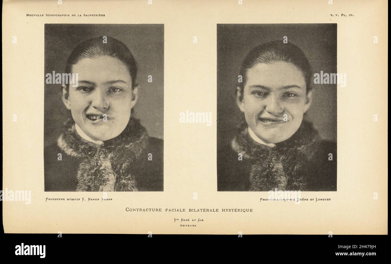 Different facial features hi-res stock photography and images - Alamy