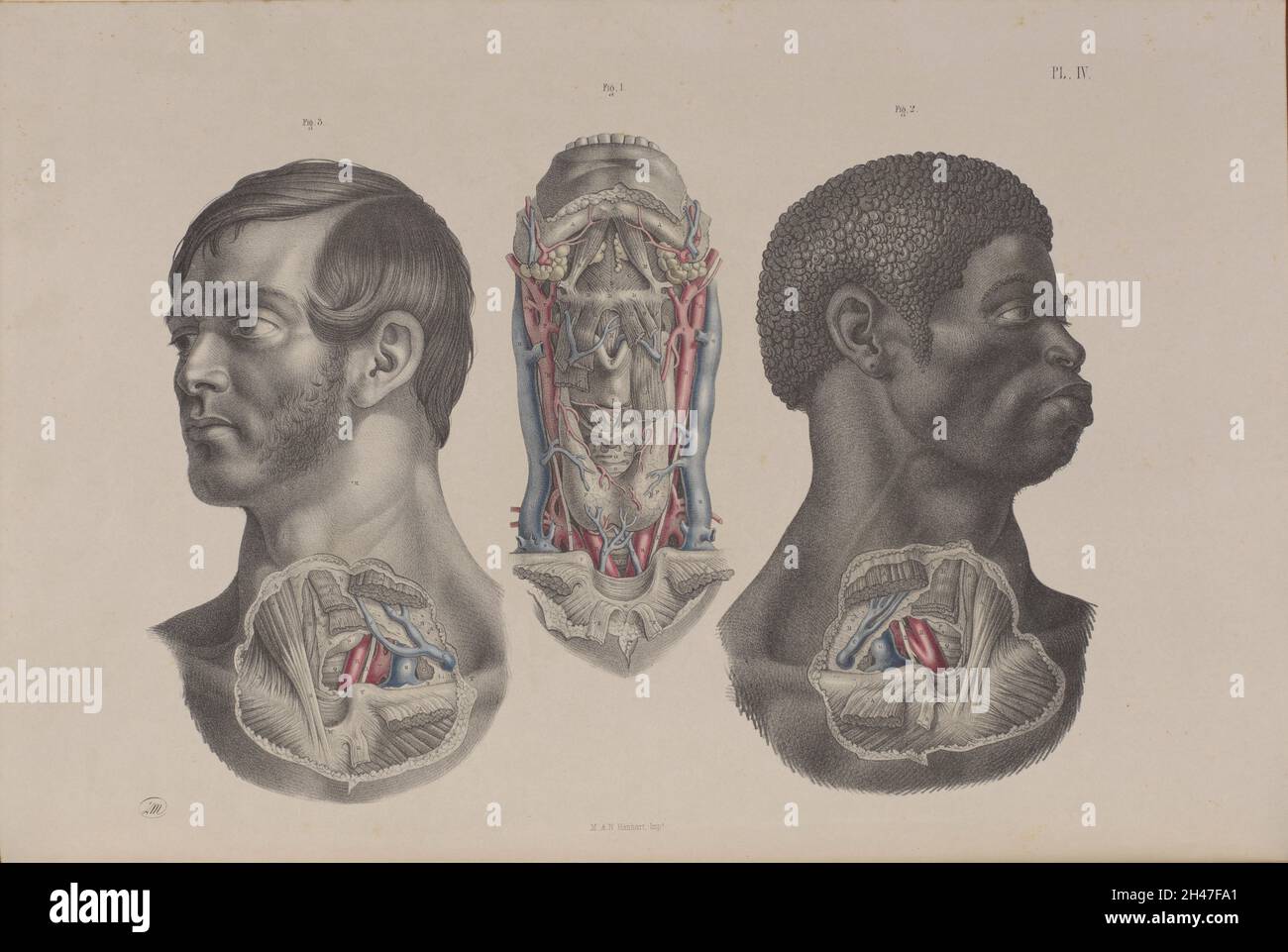 Plate IV. The surgical dissection of the thorax Stock Photo - Alamy