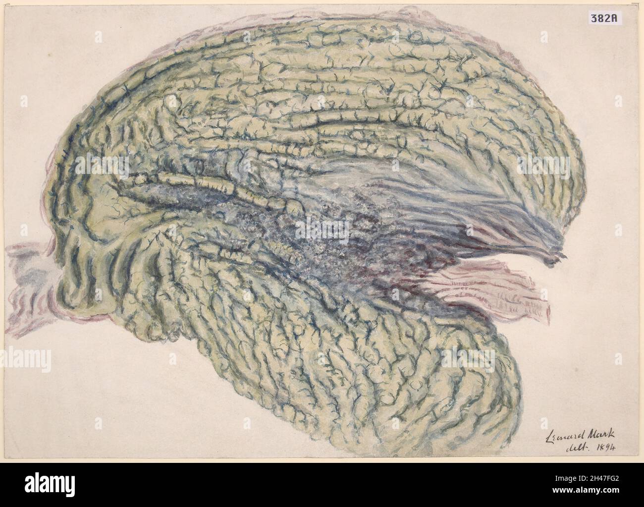 Oesophagus, stomach and intestine from a case of poisoning by ...