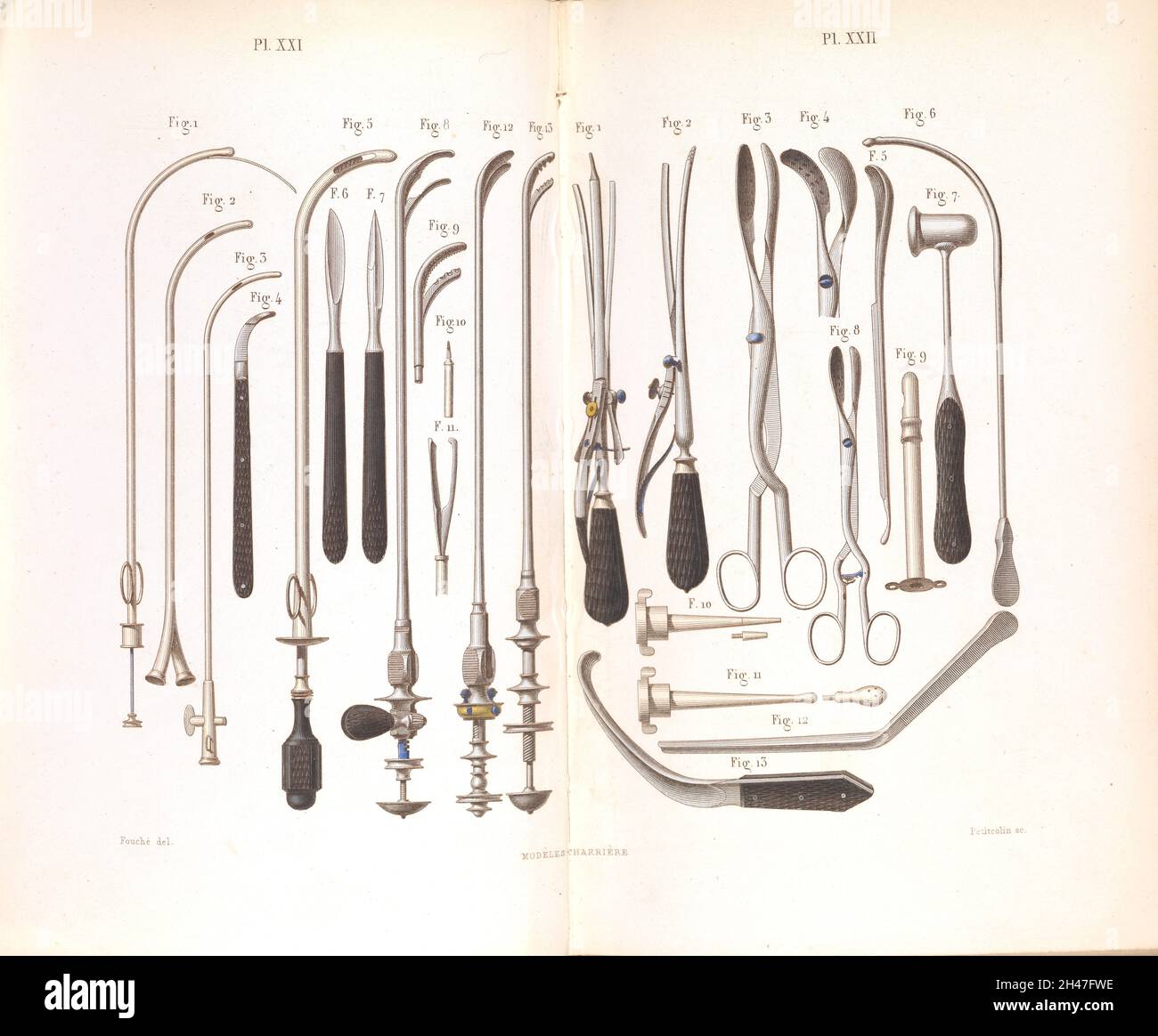Plate XXI-XXII, Surgical instruments for lithotripsy Stock Photo - Alamy