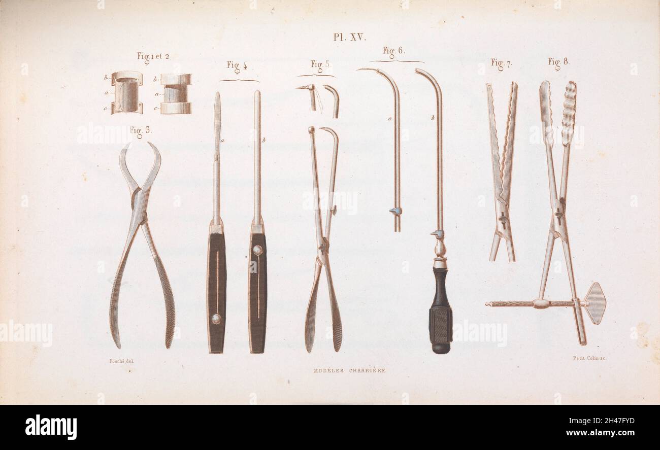 Plate XV, Surgical instruments used to repair an abdominal hernia Stock ...