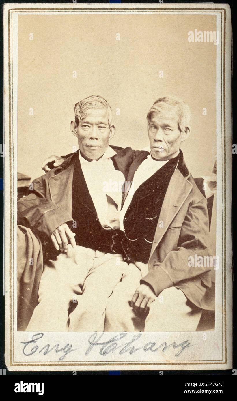 Chang and Eng, conjoined twins, seated. Photograph, c. 1860 Stock Photo ...