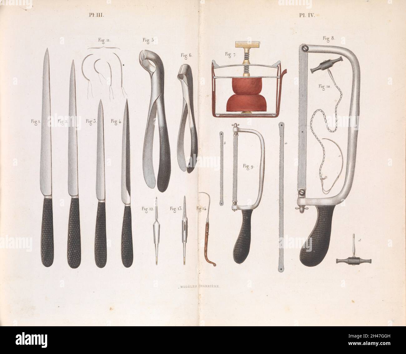 Plates III-IV, Surgical instruments used for amputations Stock Photo ...