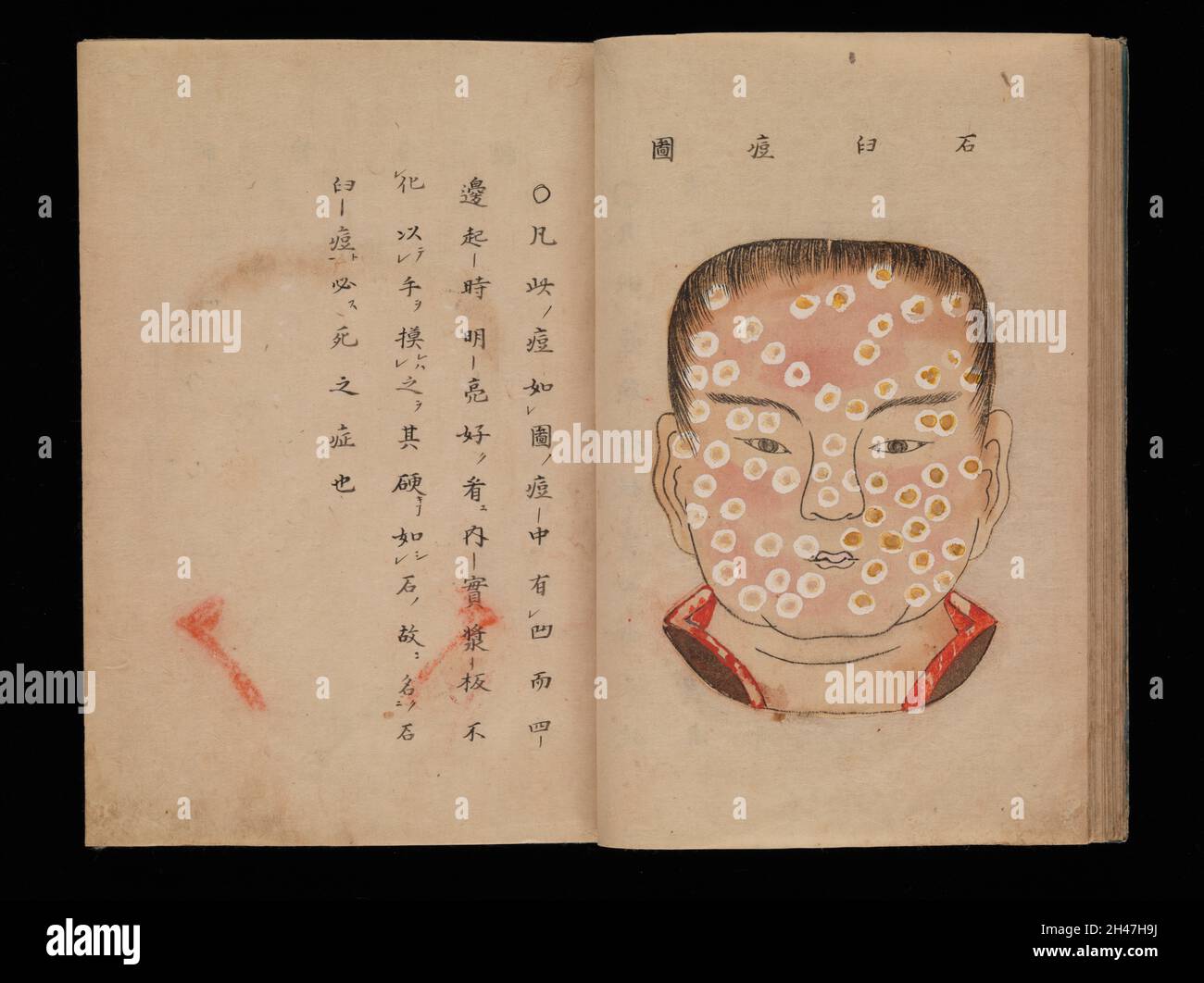 Japanese medical history hi-res stock photography and images - Alamy