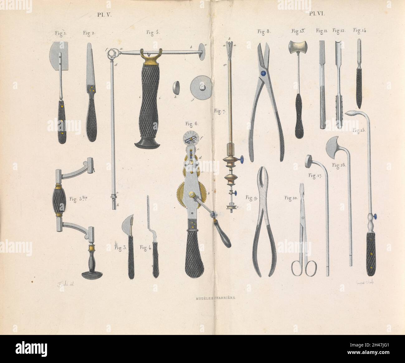 Plate V-VI, Surgical instruments used for resection surgery Stock Photo ...