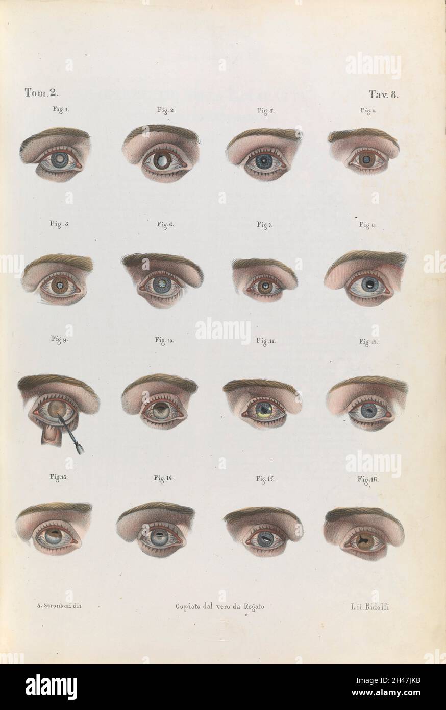 Plate 8. Illustration of various eye diseases Stock Photo - Alamy
