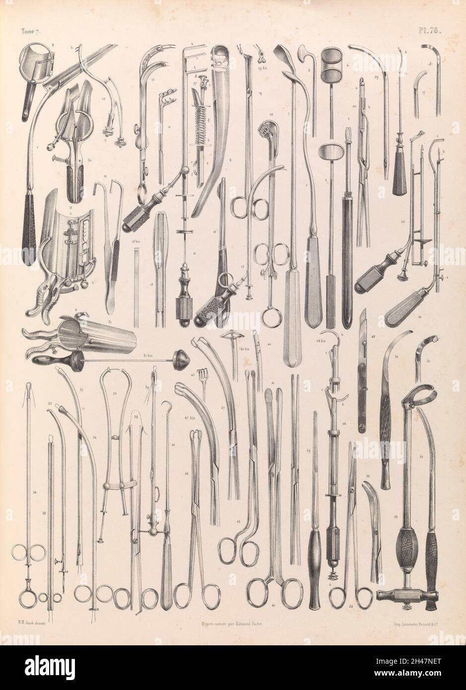 Plate 76. Surgical instruments - female reproductive organs Stock Photo ...