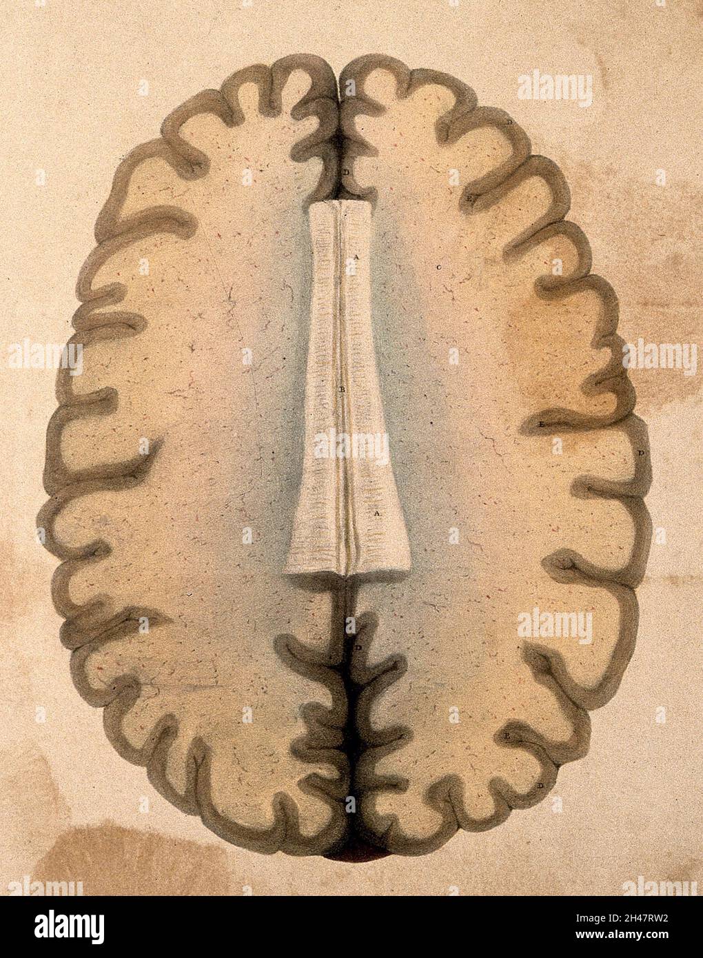 Cross section brain corpus callosum hi-res stock photography and images ...