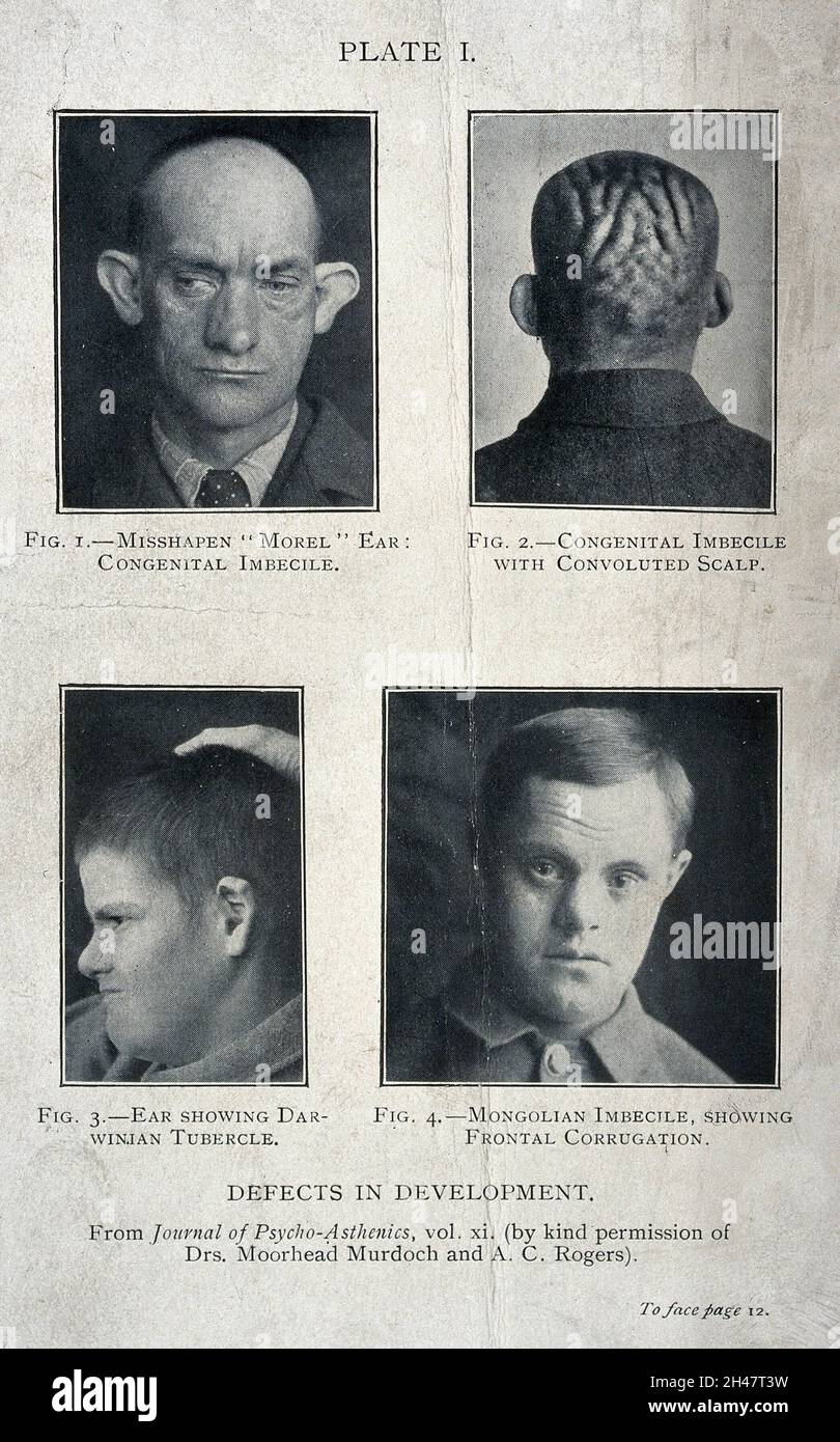 A man's head seen from the front and back, showing large ears and a ...