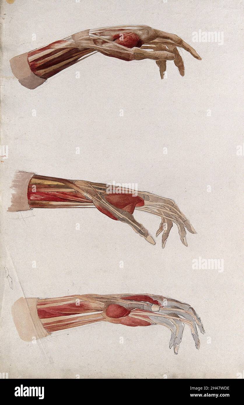 Three dissections of the right hand and wrist, showing the muscles and ...