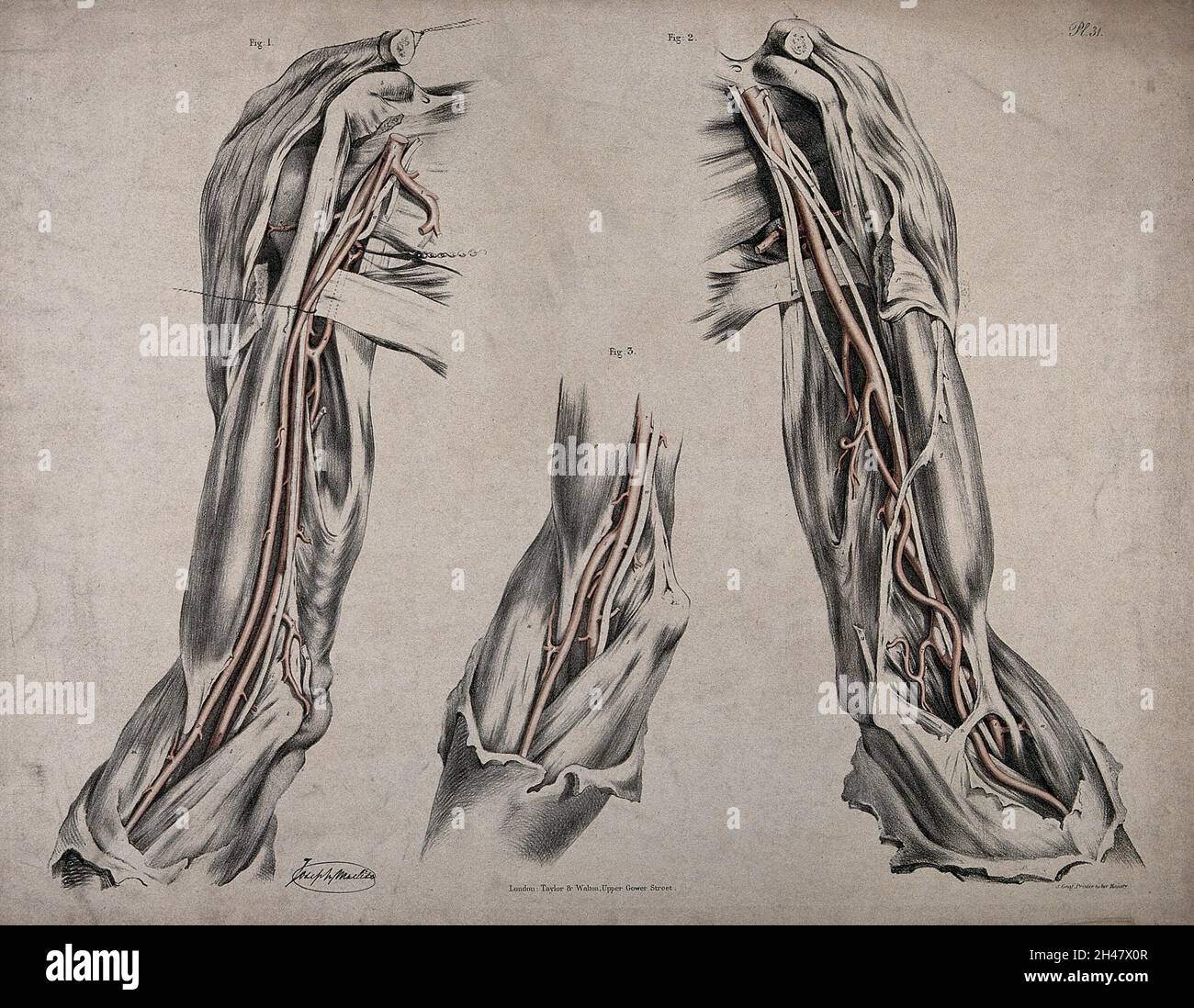 The circulatory system: dissections of the upper arm, shoulder and ...