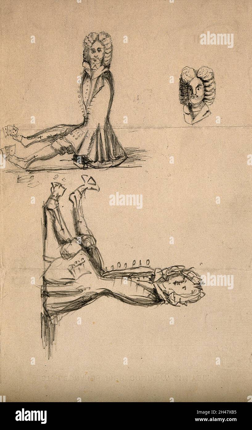 A man born without arms, holding playing cards in his toes. Pencil ...