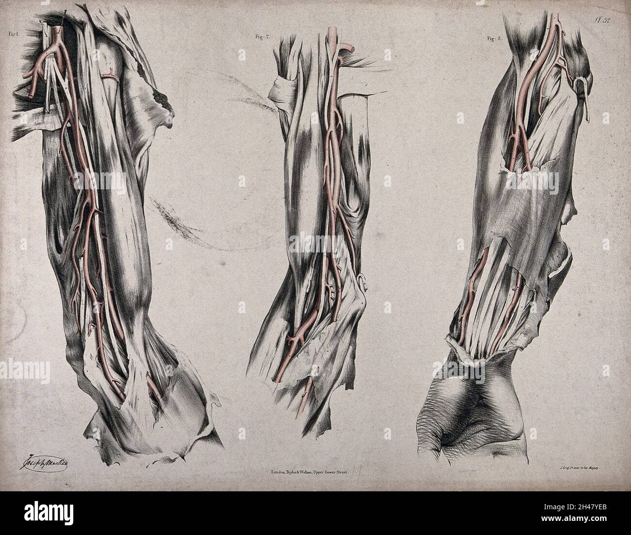 The circulatory system: three dissections of the arm, with arteries and ...
