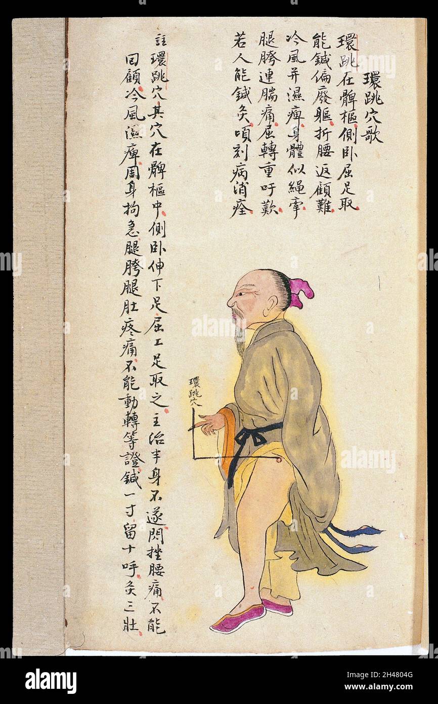 C19 Chinese MS moxibustion point chart: Huantiao Stock Photo - Alamy