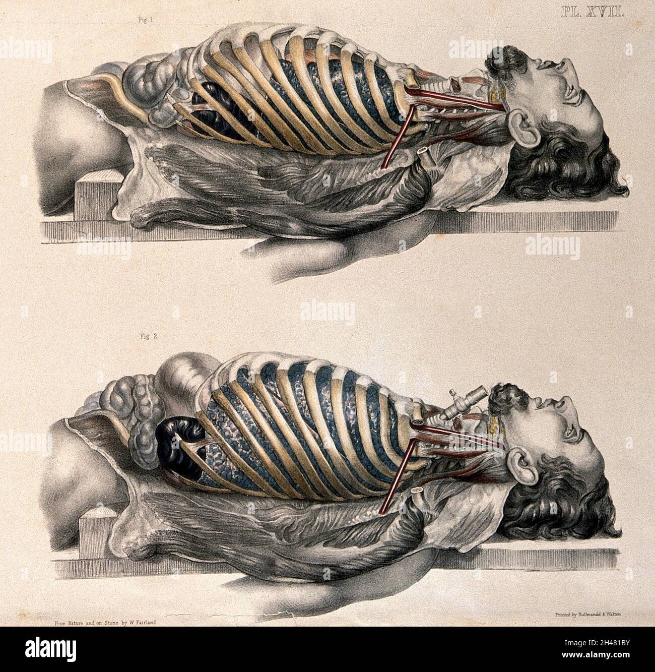 The body of a man lying down with the trunk dissected: two figures ...