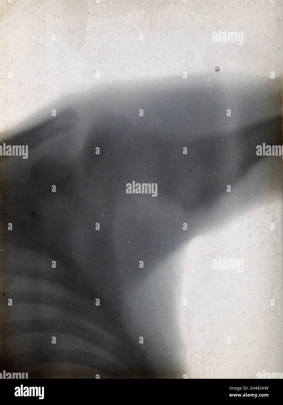 Photoprint radiograph hi-res stock photography and images - Alamy