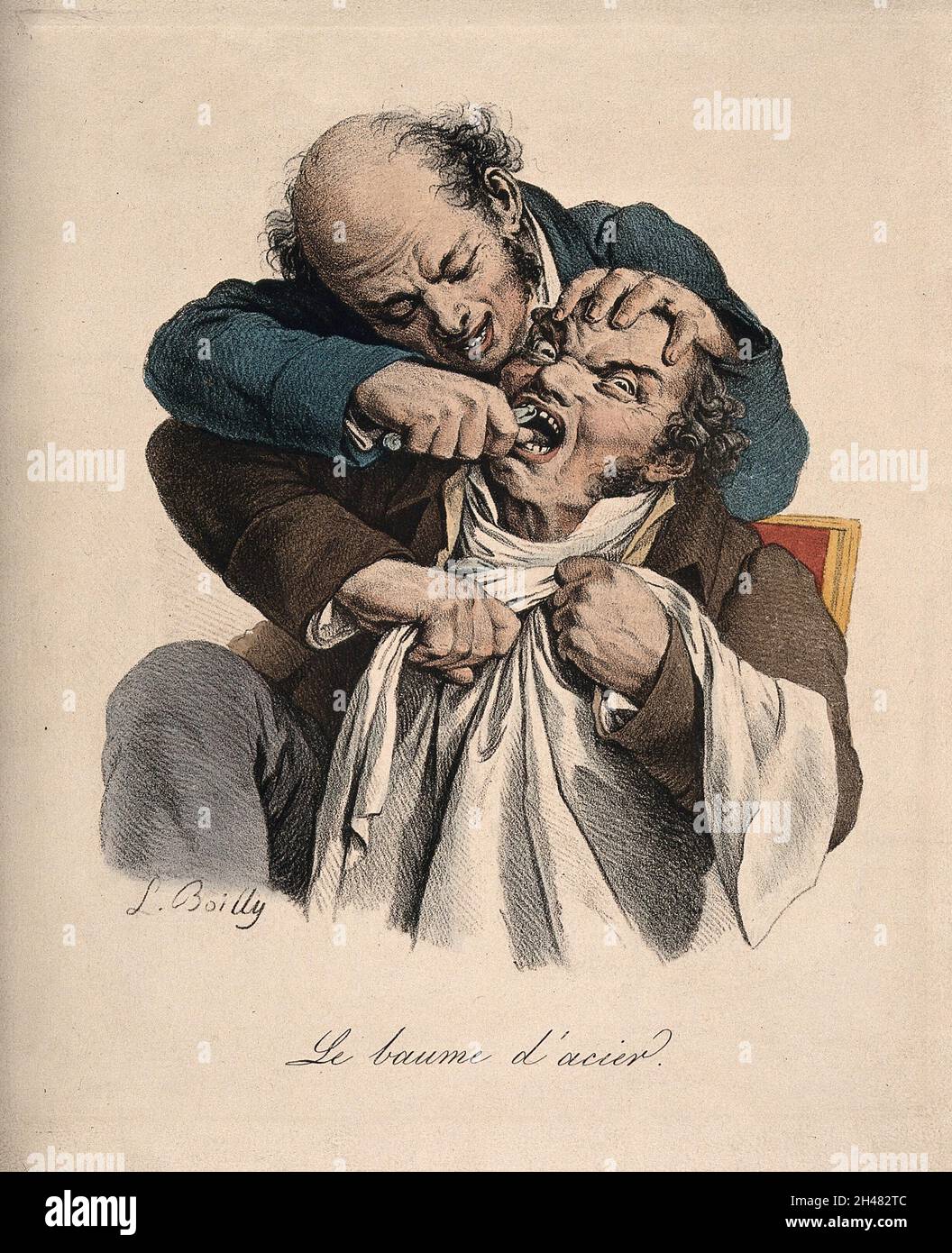 A tooth-drawer extracting a tooth from a grimacing patient. Coloured ...