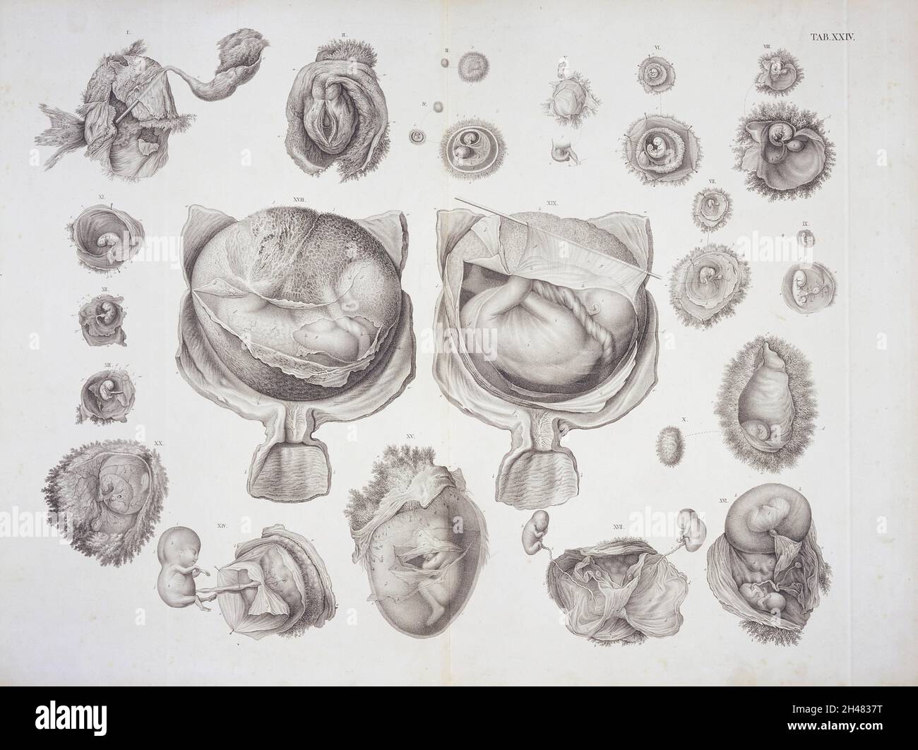 Fetal development stages hi-res stock photography and images - Alamy