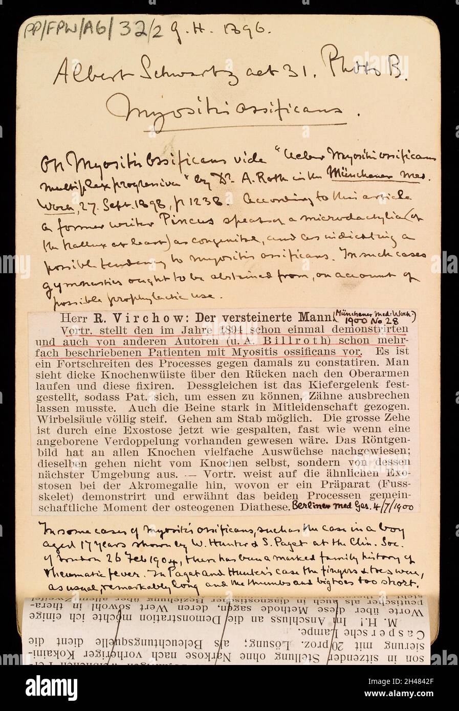 Albert Schwartz aet 31. photo B. Myositis ossificans Stock Photo - Alamy