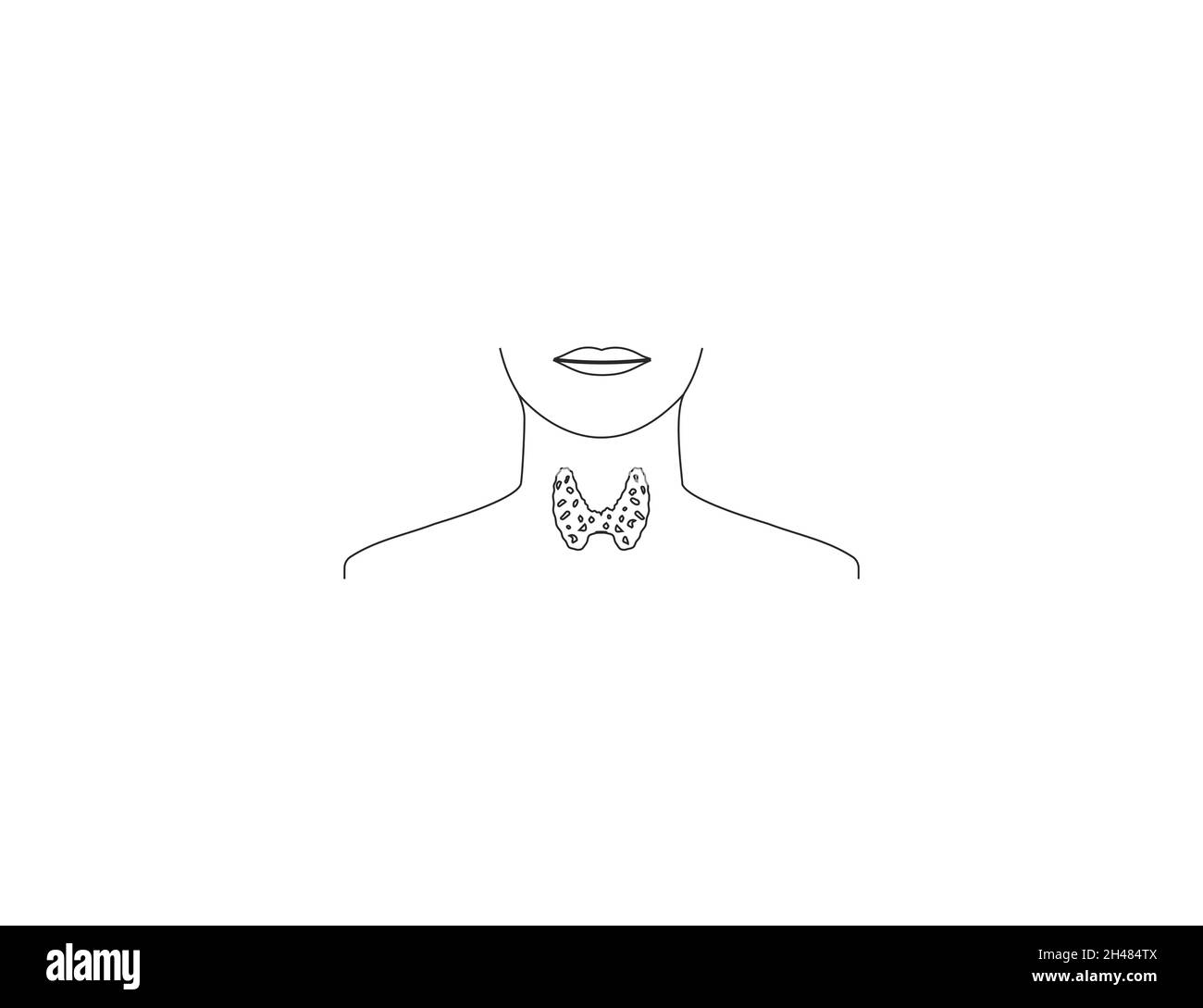 Vector illustration. Flat design. Patient medical thyroid icon Stock ...