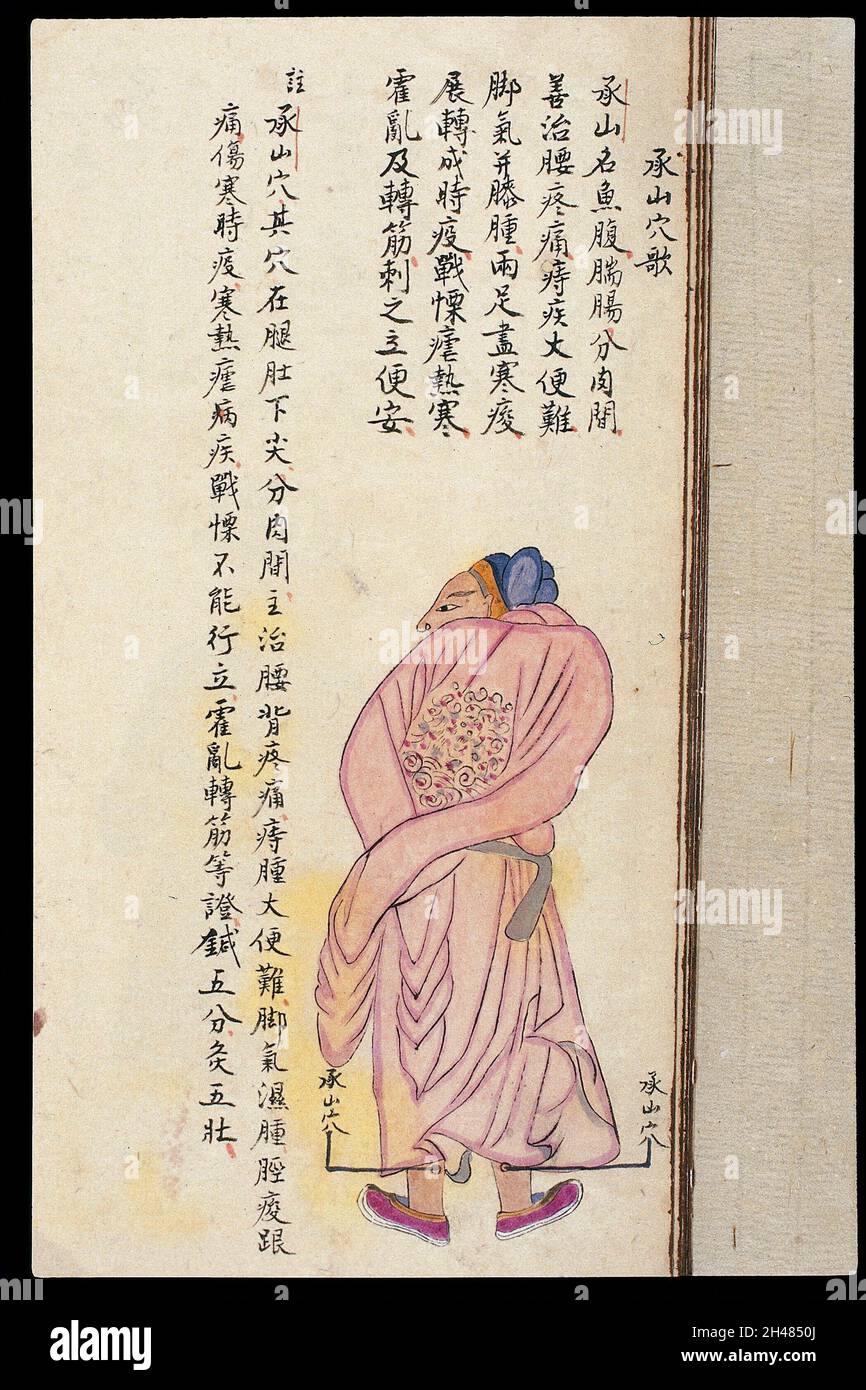 C19 Chinese MS moxibustion point chart: Chengshan Stock Photo - Alamy