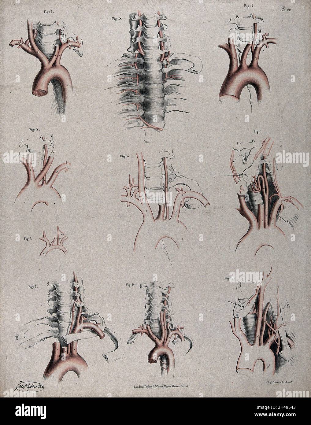 Arch ribs hi-res stock photography and images - Alamy