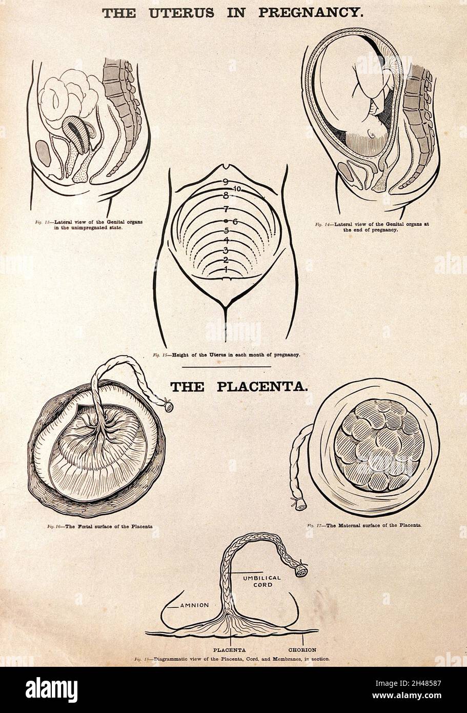 The uterus in pregnancy, and the placenta. Lithograph after W. F ...