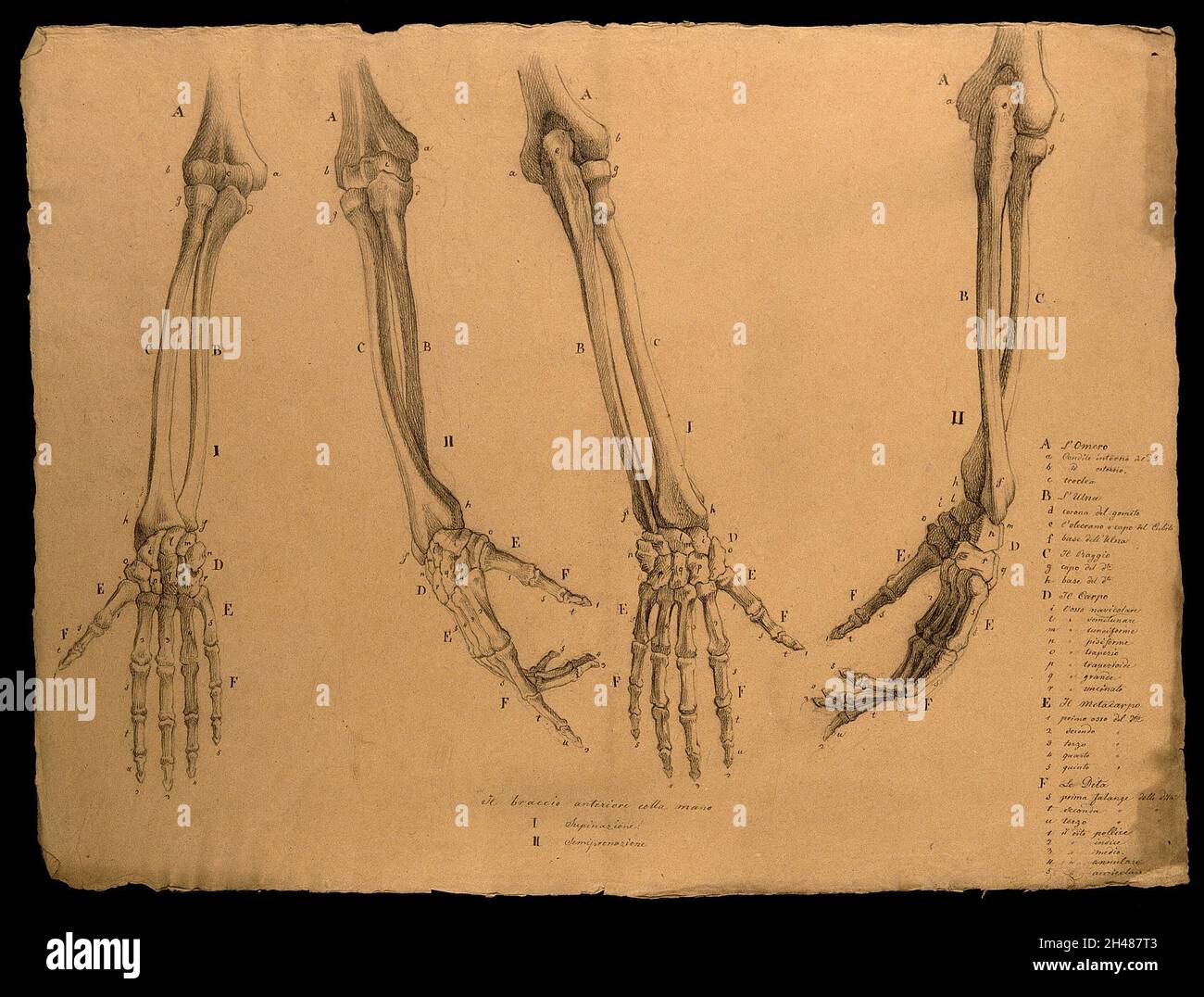 Bones of the arm and hand, shown in various stages of pronation: four ...
