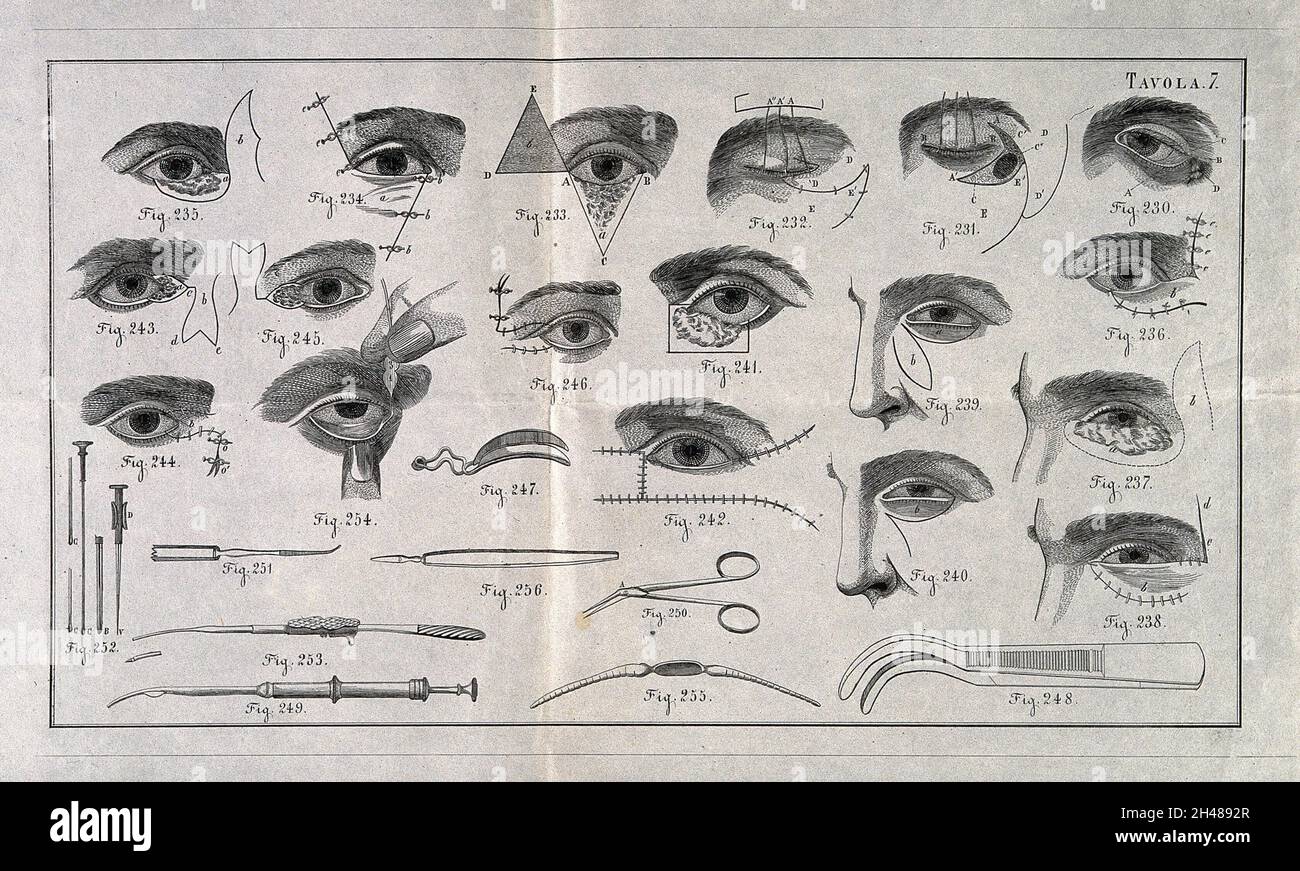 A sheet showing optical instruments, eye examinations, and diagrams of ...
