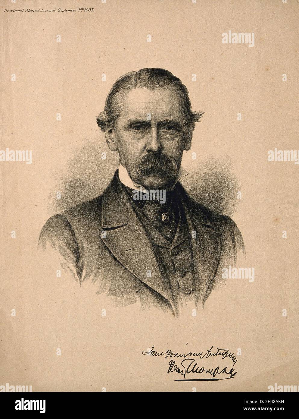 Sir Henry Thompson. Lithograph, 1887, after J. E. Millais Stock Photo ...