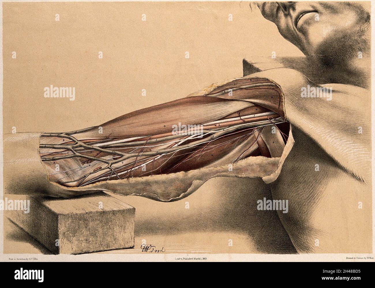 Dissection showing the muscles, blood vessels and nerves of the upper ...