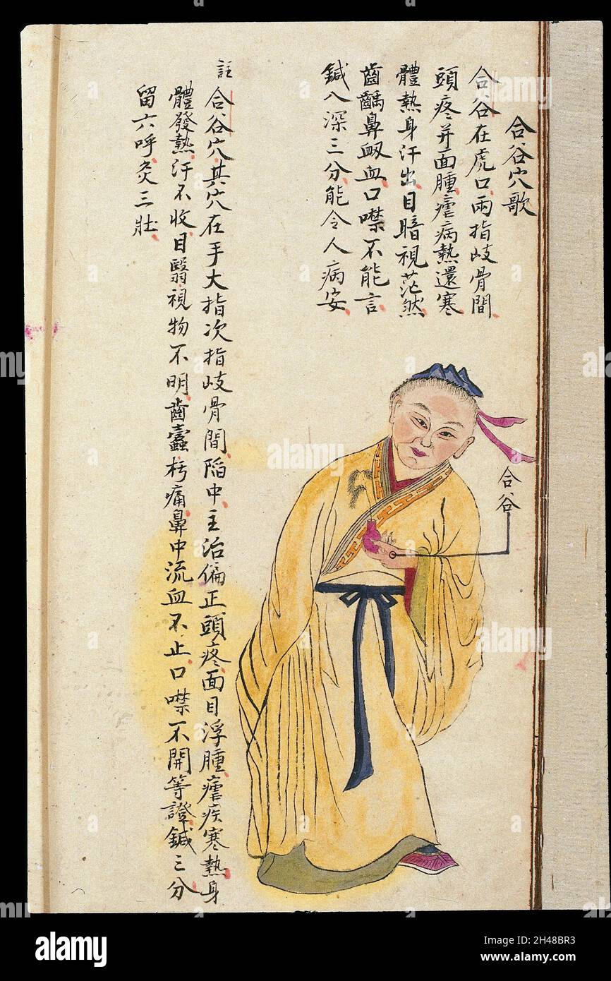 C19 Chinese MS moxibustion point chart: Hegu Stock Photo - Alamy