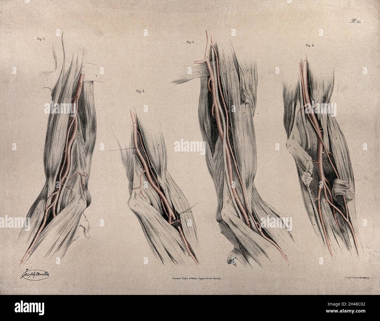 The circulatory system: dissections of the arm and elbow, with arteries ...