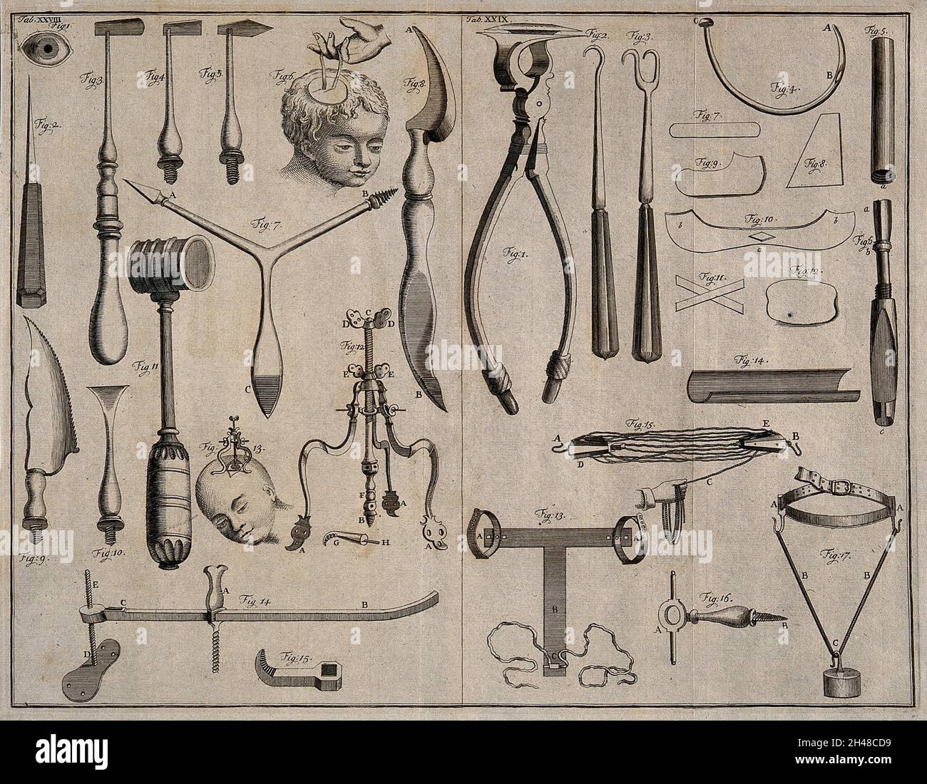 Surgical instruments for trepanation. Engraving with etching Stock ...