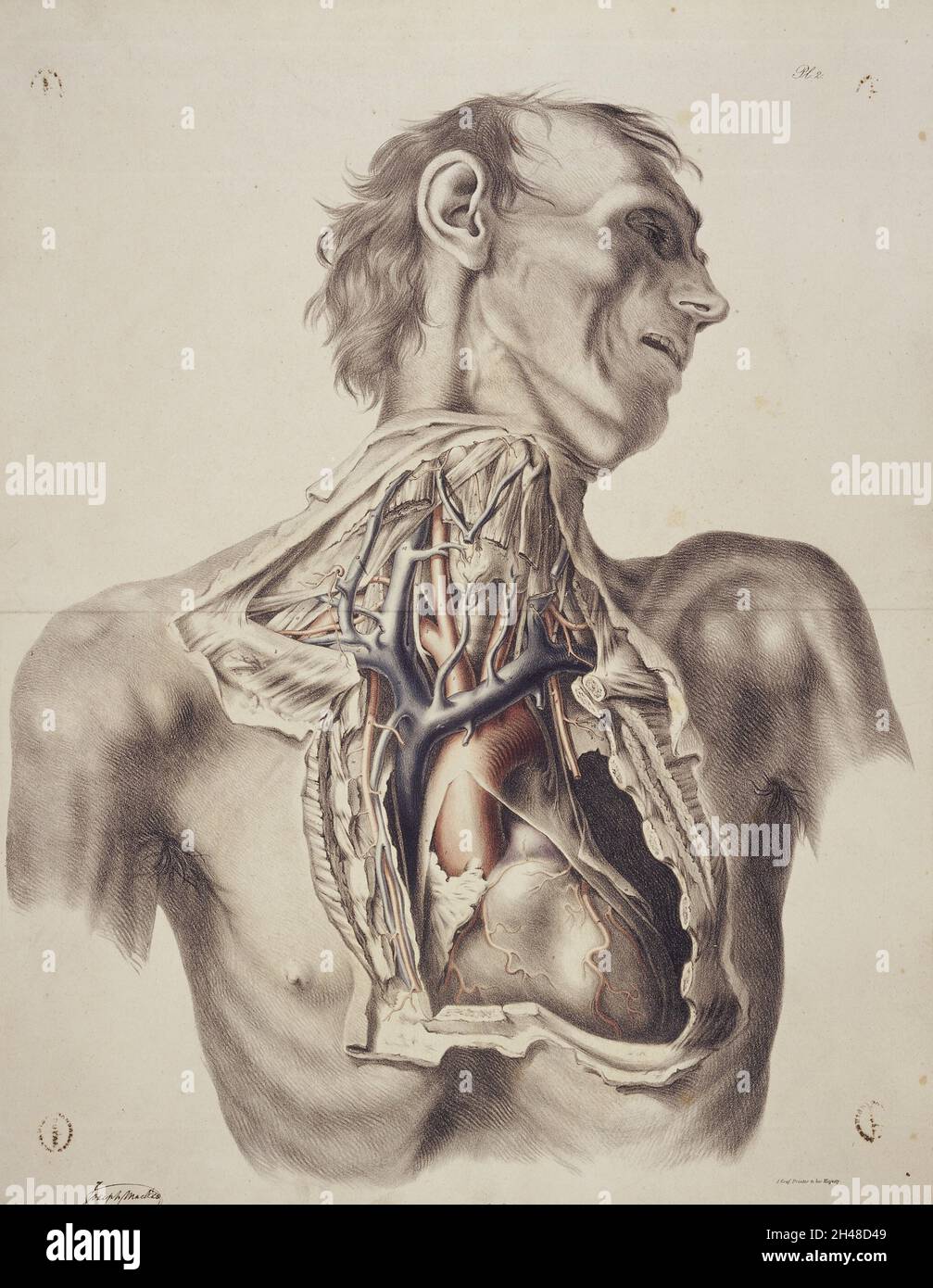 The large arteries of thorax and neck Stock Photo - Alamy