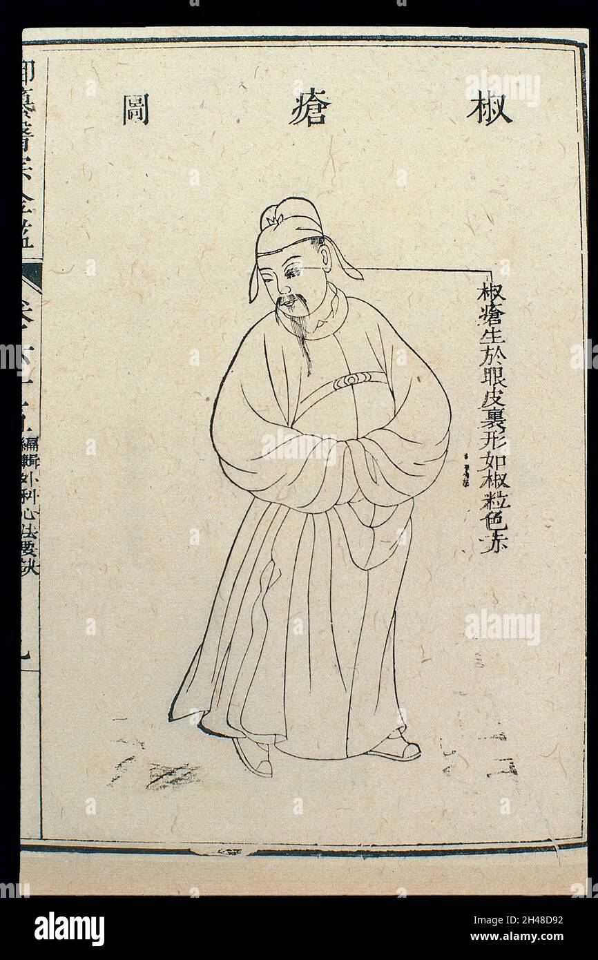 Chinese C18 woodcut: External eye - Sore on eyelid Stock Photo - Alamy