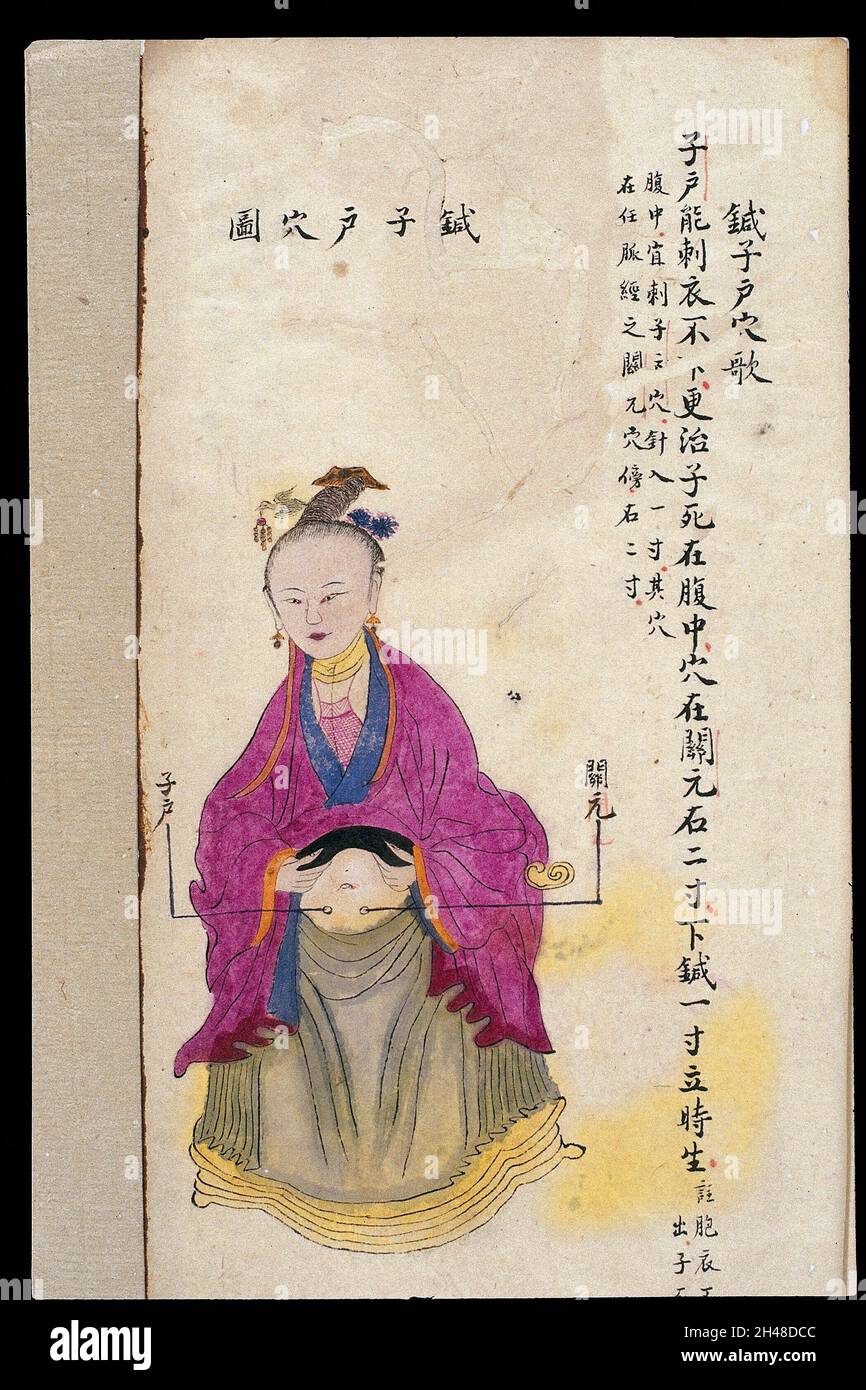 C19 Chinese MS moxibustion point chart: Cervix point Stock Photo - Alamy