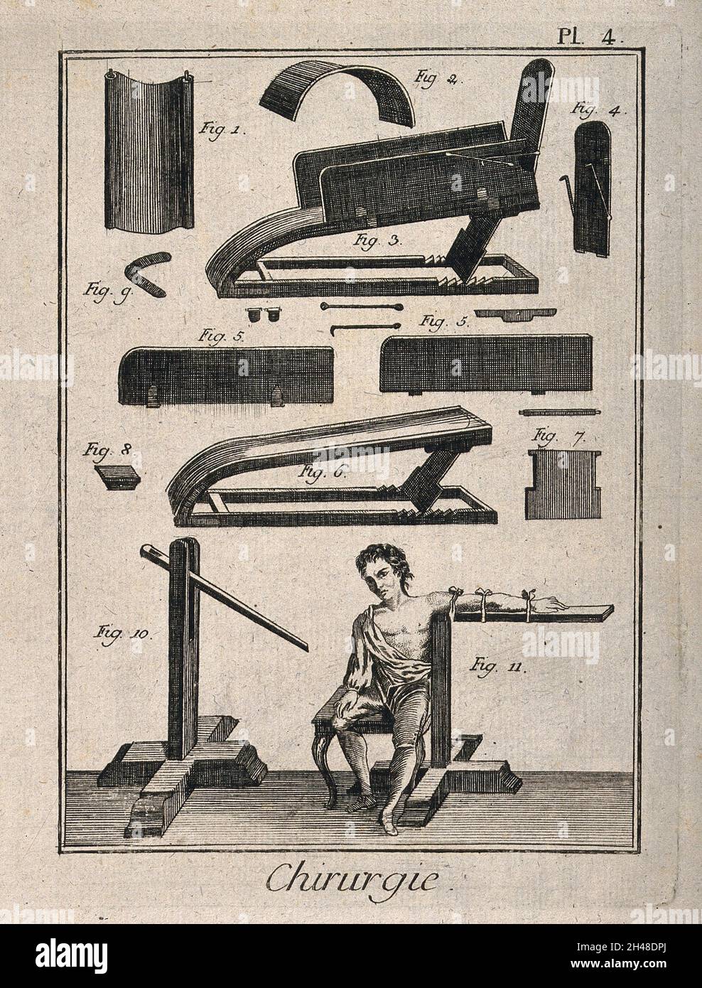 Surgical instruments and patients undergoing treatment. Engraving with ...