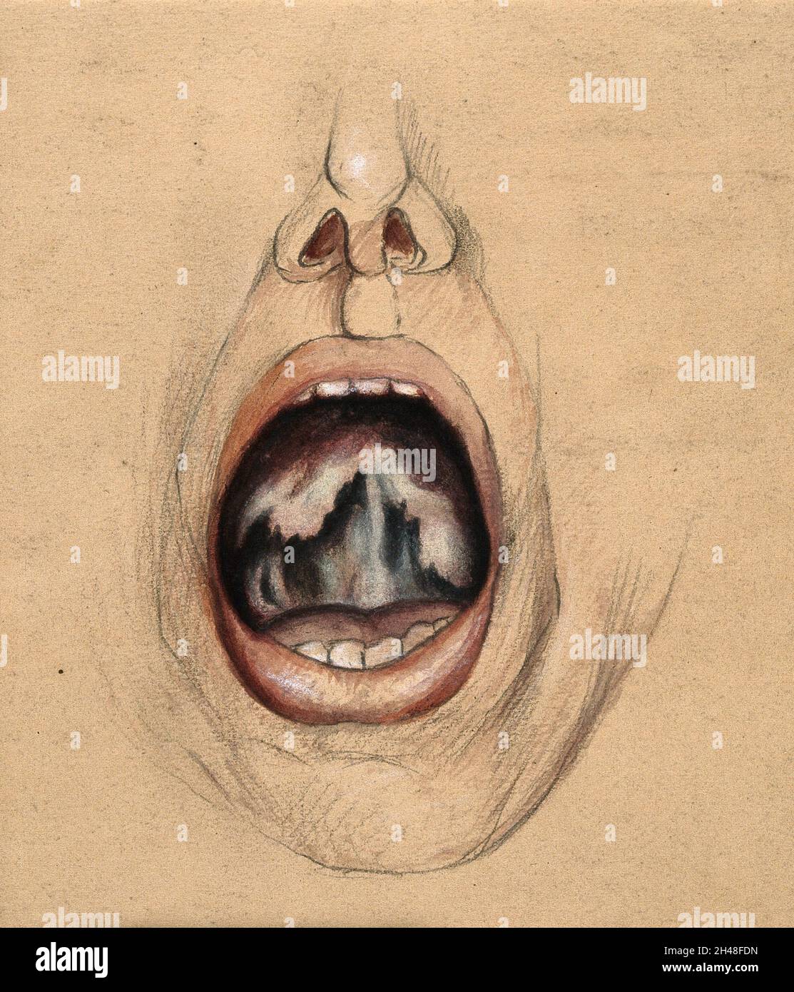 Soft palate mouth hi-res stock photography and images - Alamy