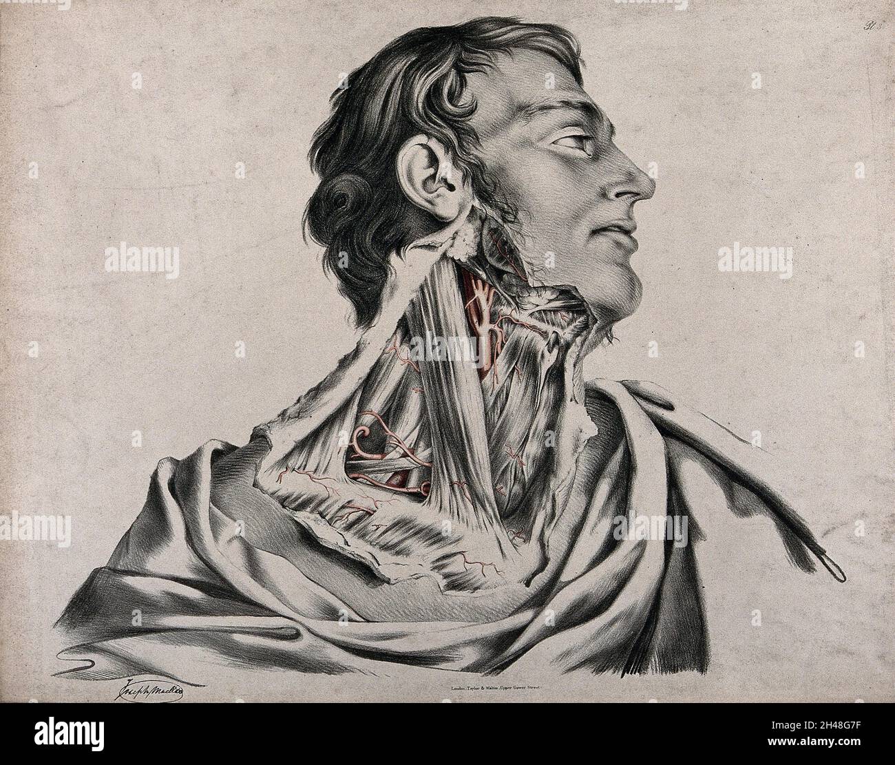 The circulatory system: dissection of the neck of a man, with arteries ...