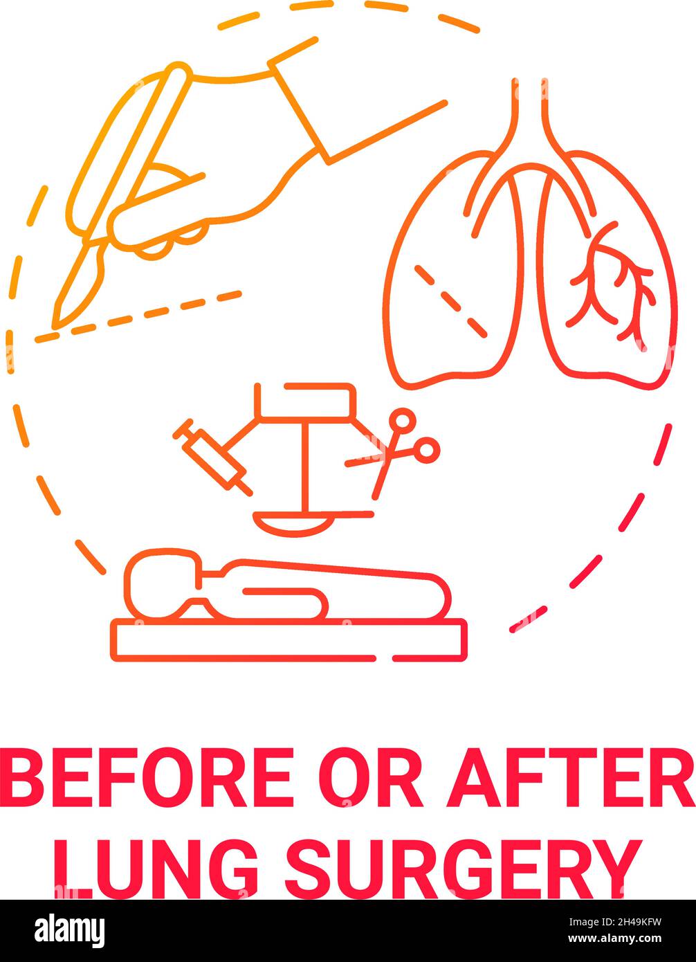 Before and after lung surgery red gradient concept icon Stock Vector ...