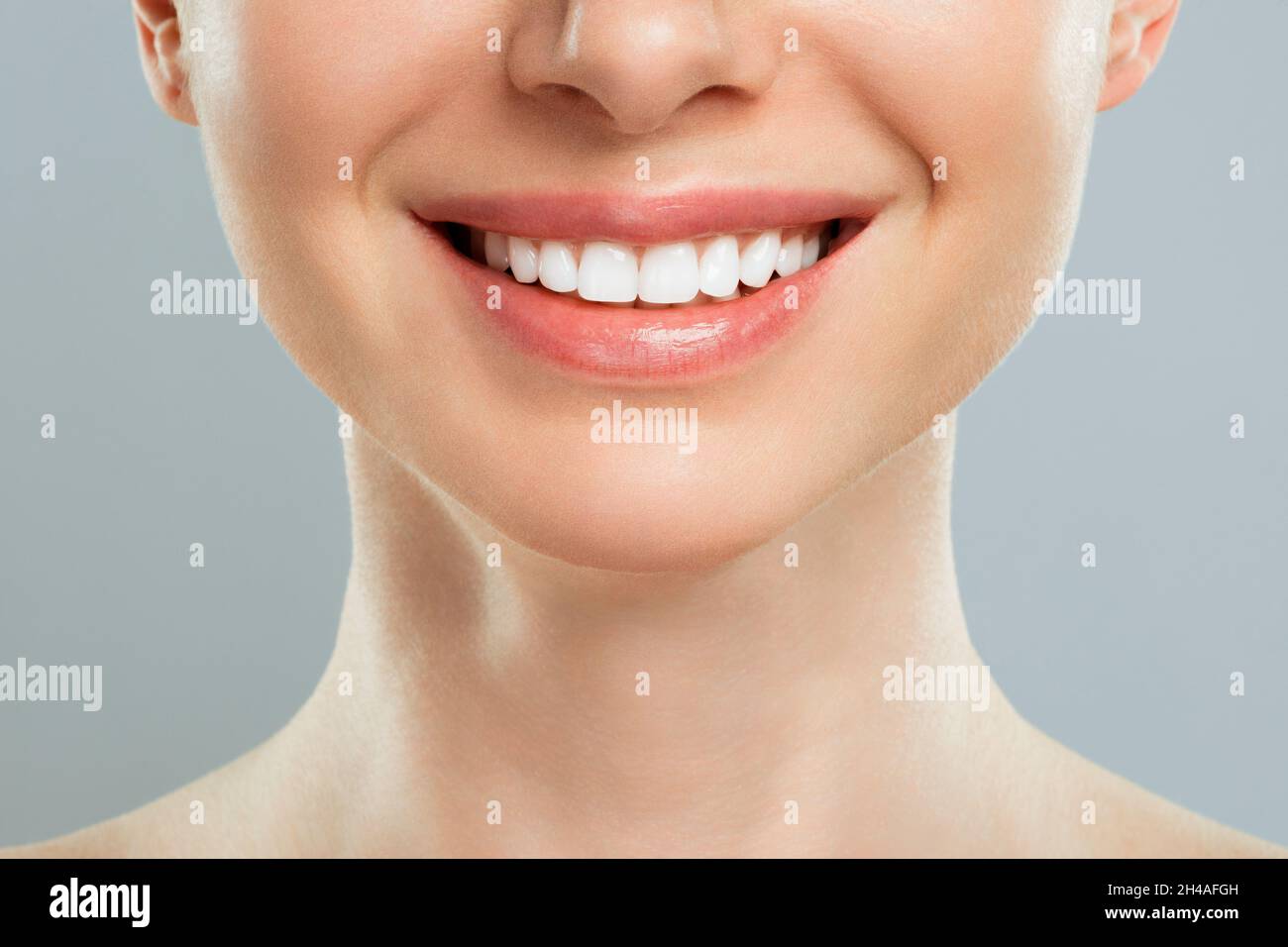 Beautiful female smile after teeth whitening procedure. Dental care ...
