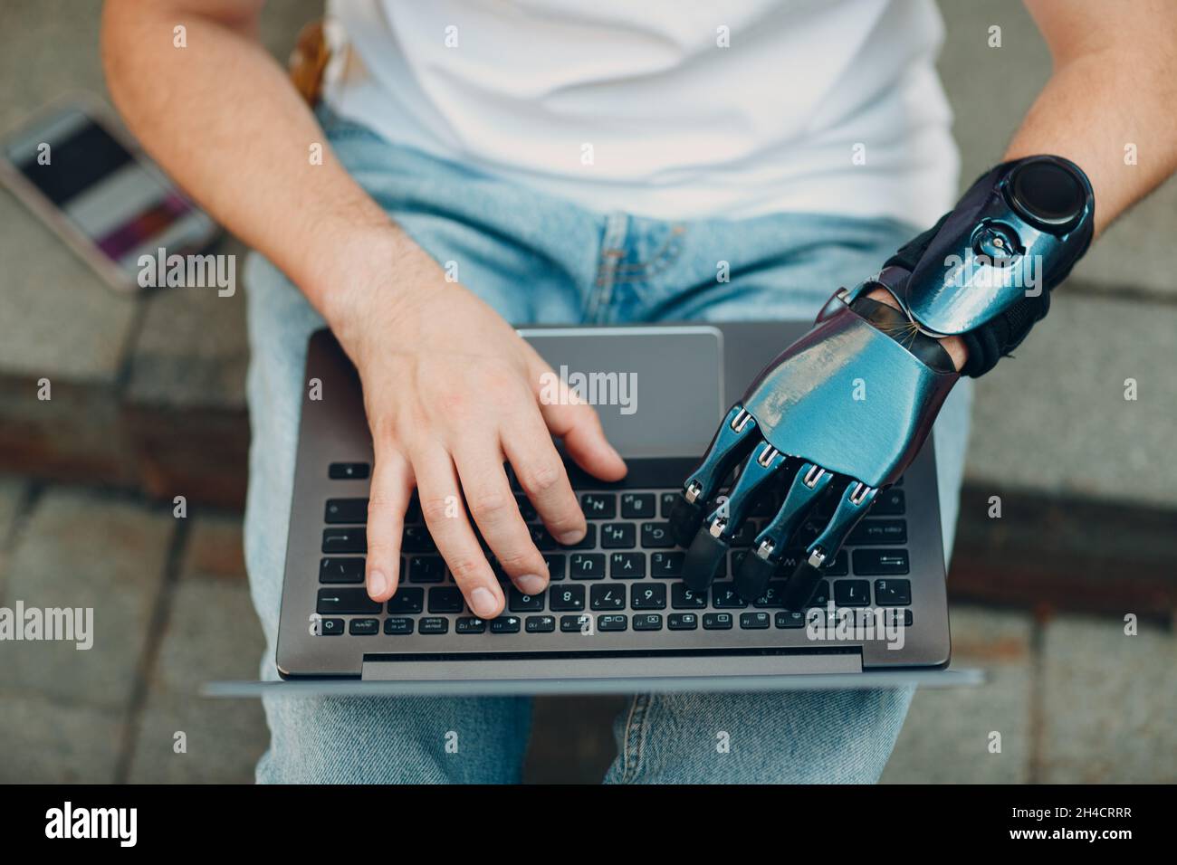 Young disabled man with artificial prosthetic hand using typing on ...