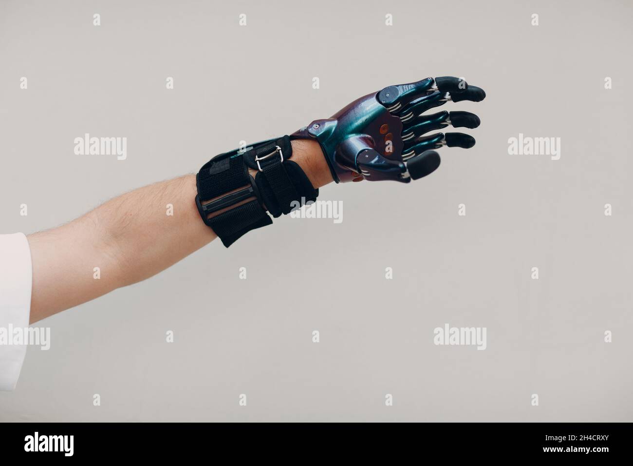 Disabled man with artificial prosthetic hand close up male hand against ...