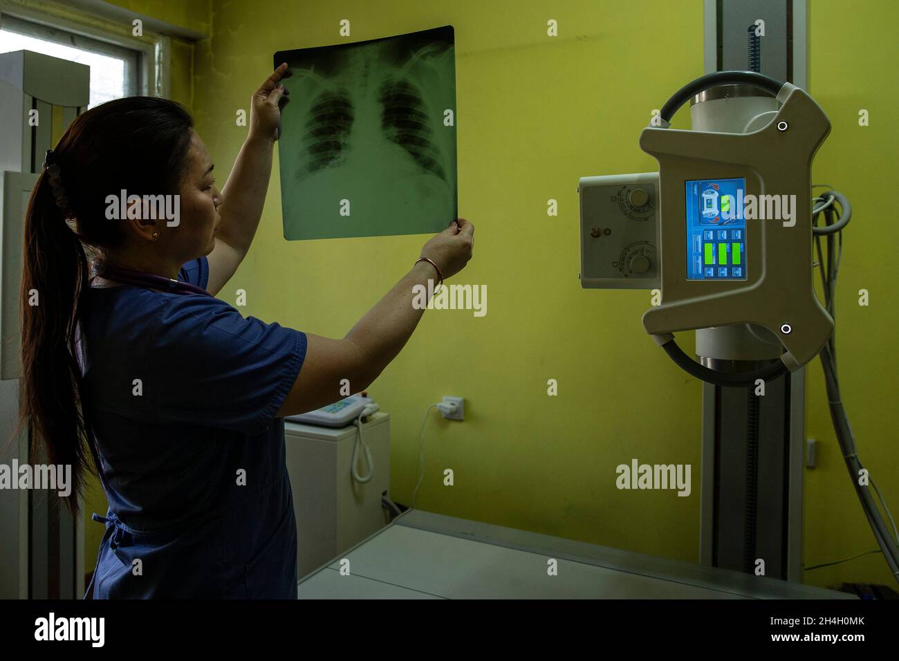 X ray school bus hi-res stock photography and images - Alamy