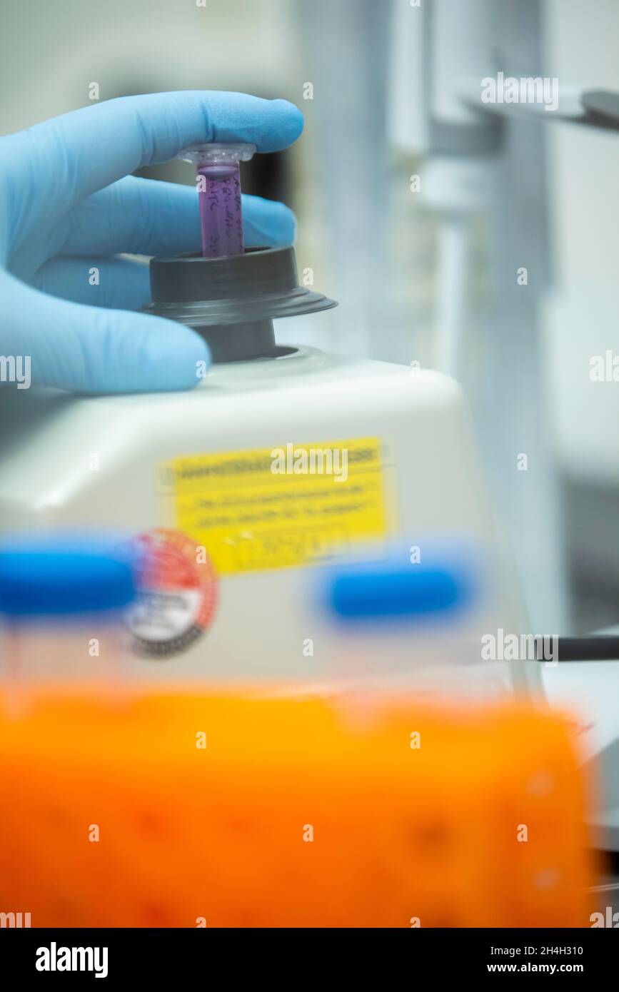 Hand of a medical laboratory assistant holding a reaction vessel in the ...