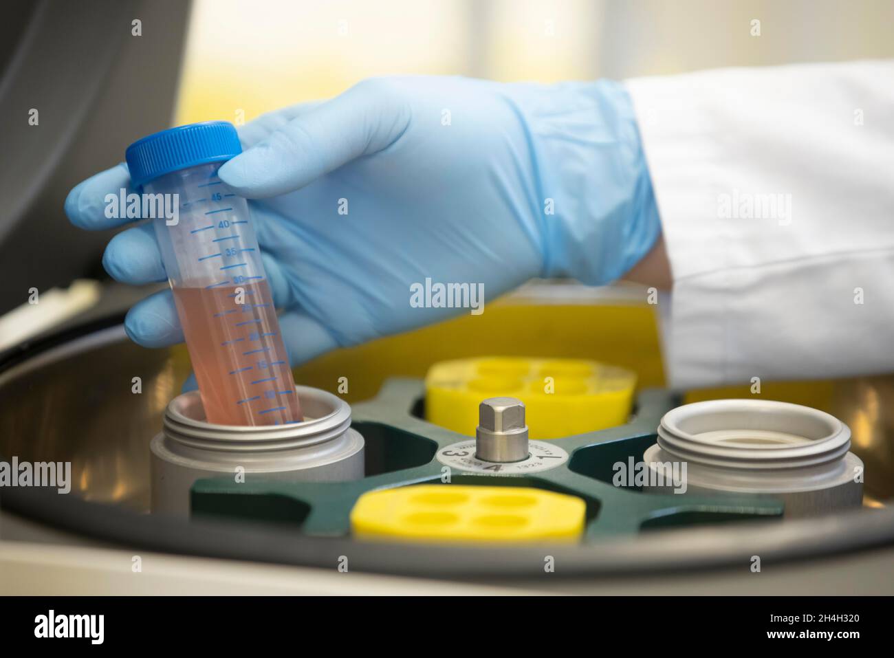 Hand of a medical laboratory assistant takes a centrifuge tube with ...