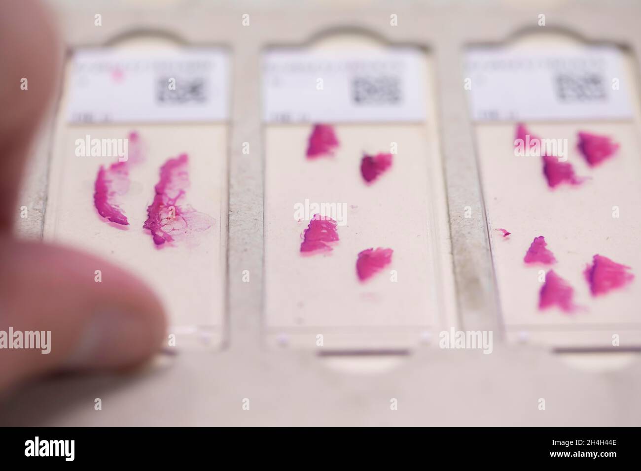Embedded samples in a histology laboratory, Freiburg, Baden ...