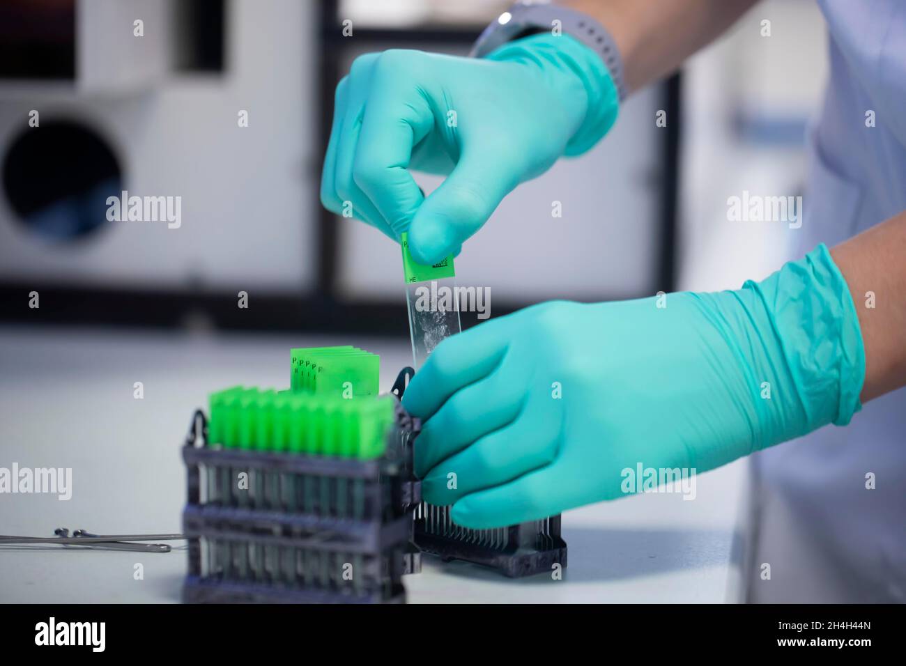Processing of samples in a histology laboratory, Freiburg, Baden ...